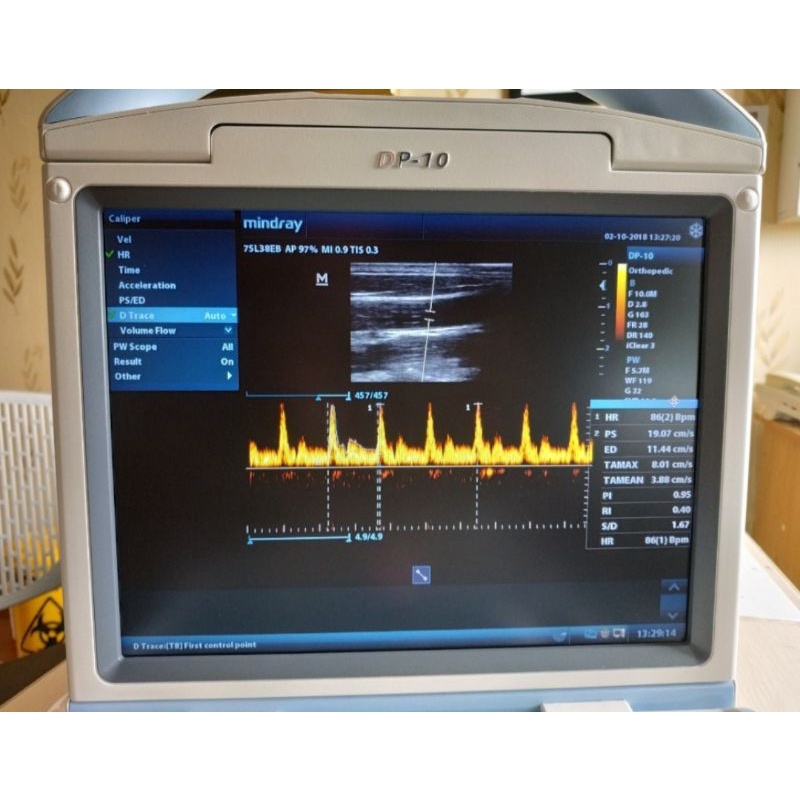 Jual USG DP10 DP-10 Bekas Second | Shopee Indonesia