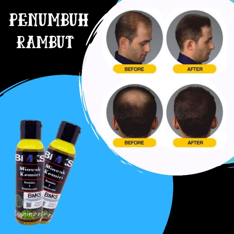 Jual PENUMBUH RAMBUT ASLI / MINYAK PENUMBUH RAMBUT | Shopee Indonesia
