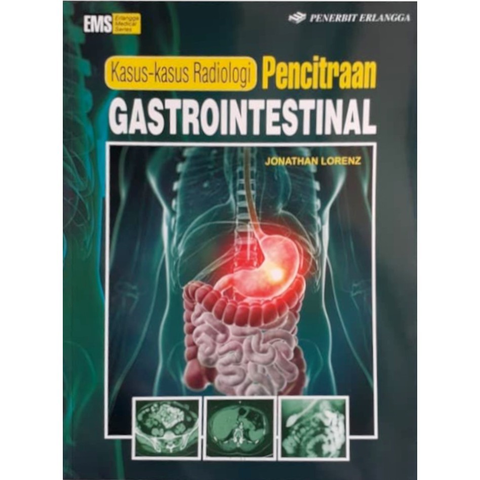 Jual Buku Erlangga Kedokteran PENCITRAAN GASTROINTESTINAL | Shopee ...