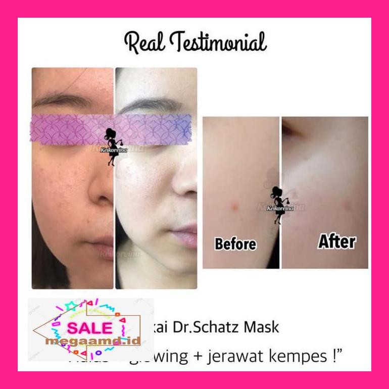 Jual 7Kemas Dr Schatz Stem Cell Mask 100% Original 1 Box - 5 Sachet 54Sksecm | Shopee Indonesia