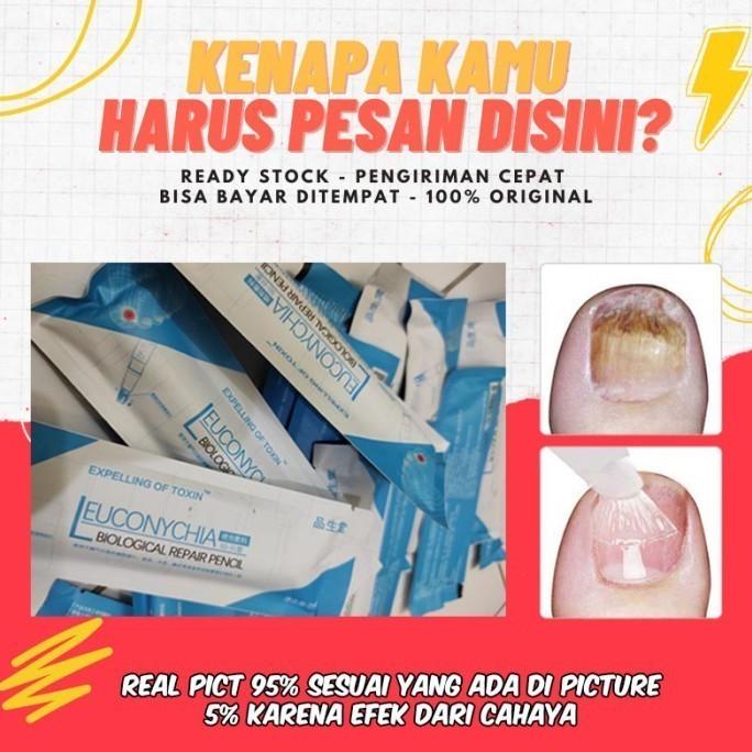 Jual JUAL MURAH cairan obat infeksi jamur kuku ORIGINAL/cairan obat ...
