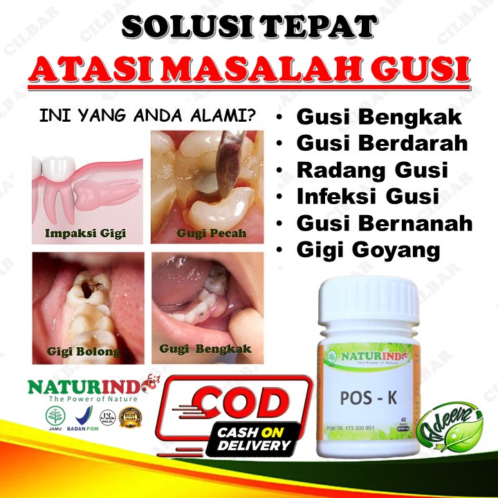 Jual Obat Gusi Bengkak Gigi Goyang Gusi Berdarah Penguat Gigi Gusi ...