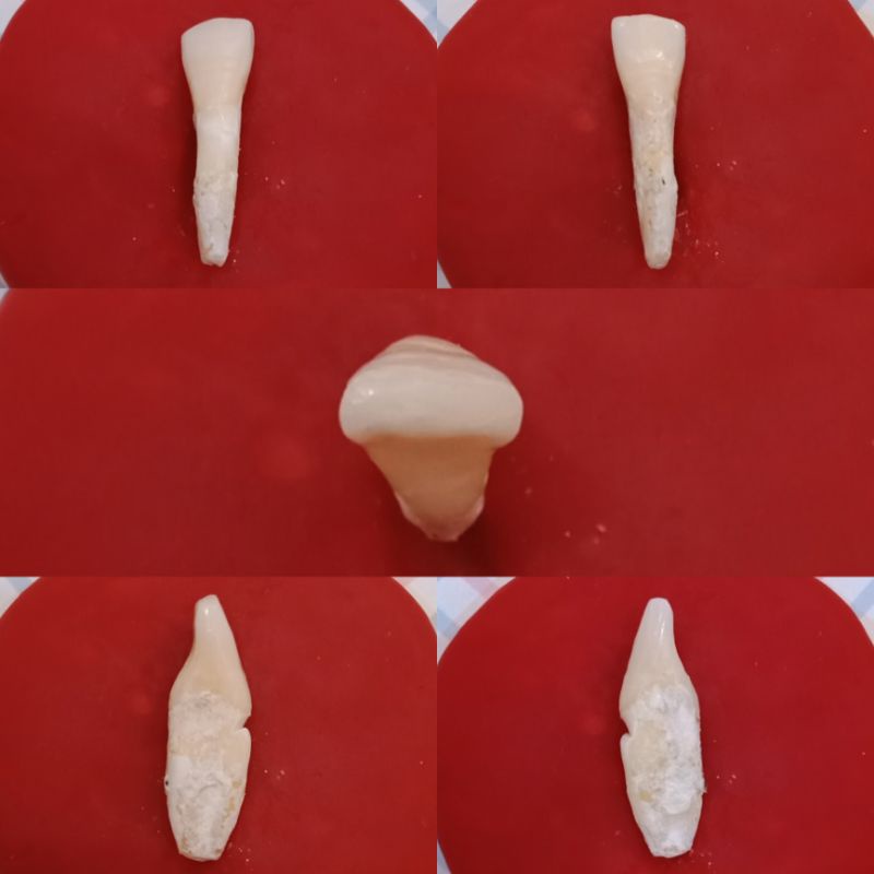 Jual Gigi 42 Gigi Asli Praktikum Gigi Insisif Lateral Kanan Rahang ...