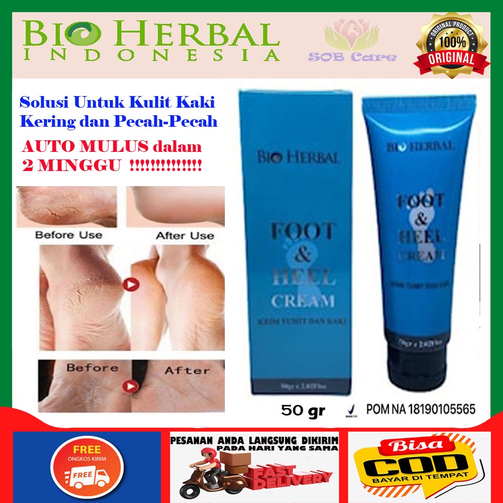 Jual Obat Salep Kapalan Penghalus Tumit Kaki Pecah Pecah dan Kering ...