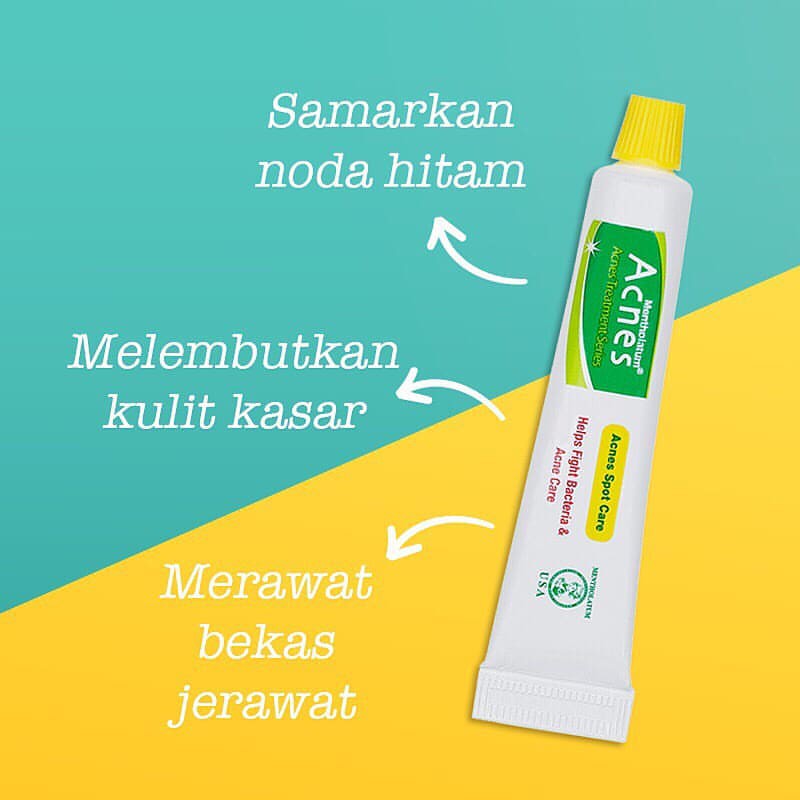 Jual Acnes Spot Care Gel | Shopee Indonesia