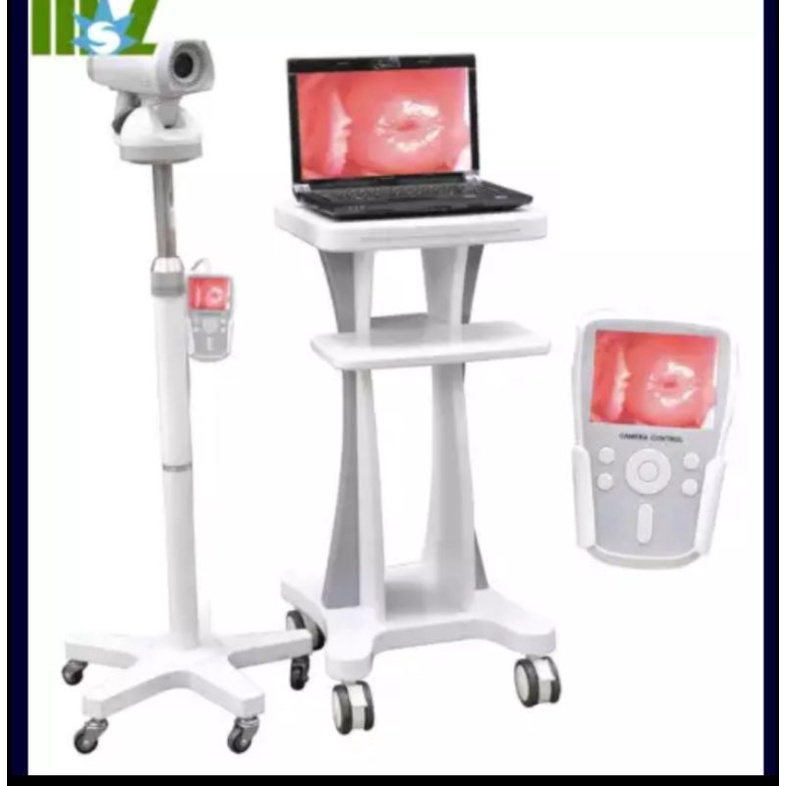 Jual Colposcope colposcopy camera control kolposkopi ( tanpa Laptop ...
