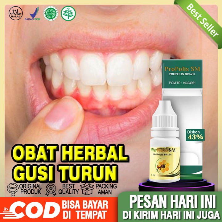 Jual Obat Gusi Turun Herbal, Obat Resesi Gusi, Gigi Turun - Propolis SM ...