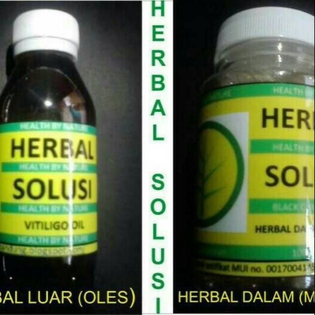 Jual Obat Herbal Vitiligo Paket Dari Herbal Solusi (vitiligo oil ...