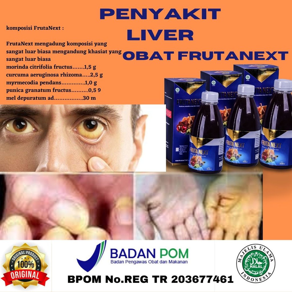 Jual FRUTANEXT Obat Liver, Hepatitis A B C D E, Herbal Liver Bengkak ...