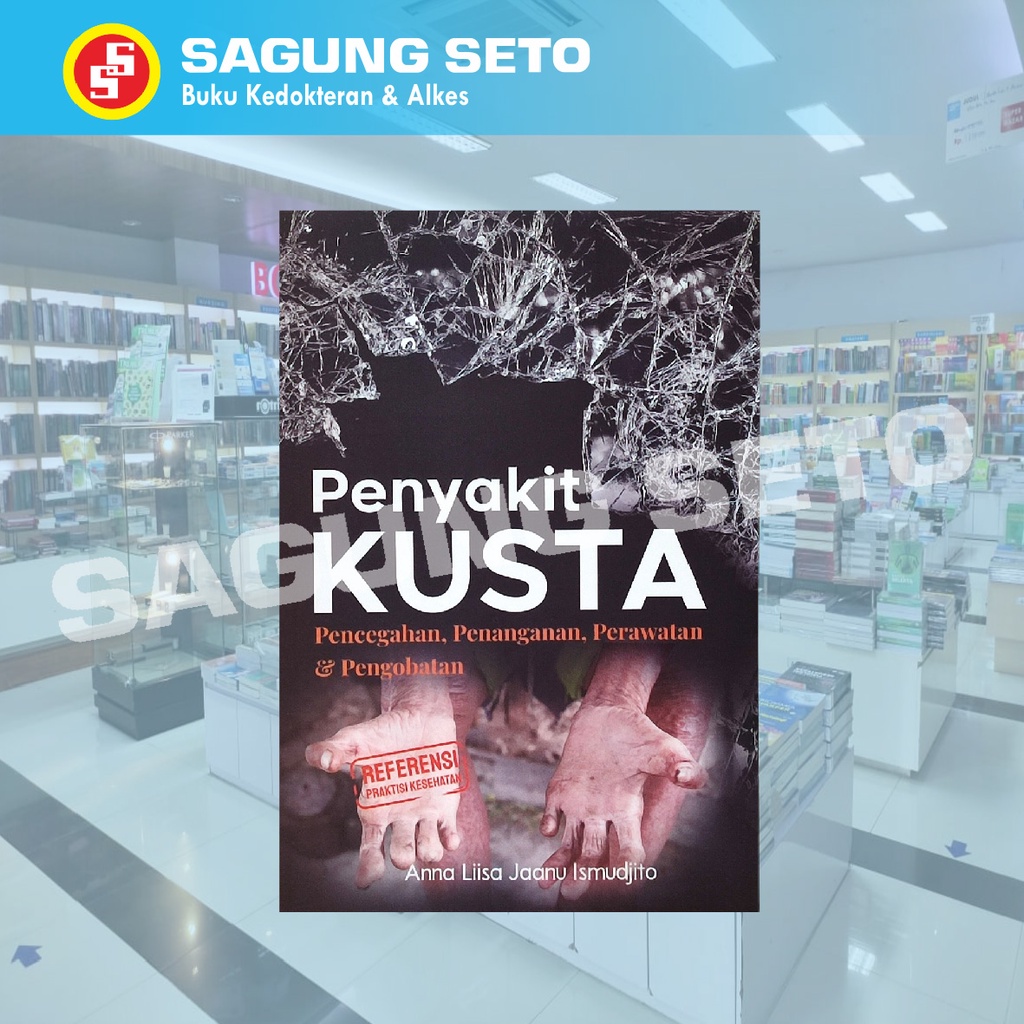 Jual BUKU PENYAKIT KUSTA PENCEGAHAN PENANGAN PERAWATAN - ANNA LIISA ...