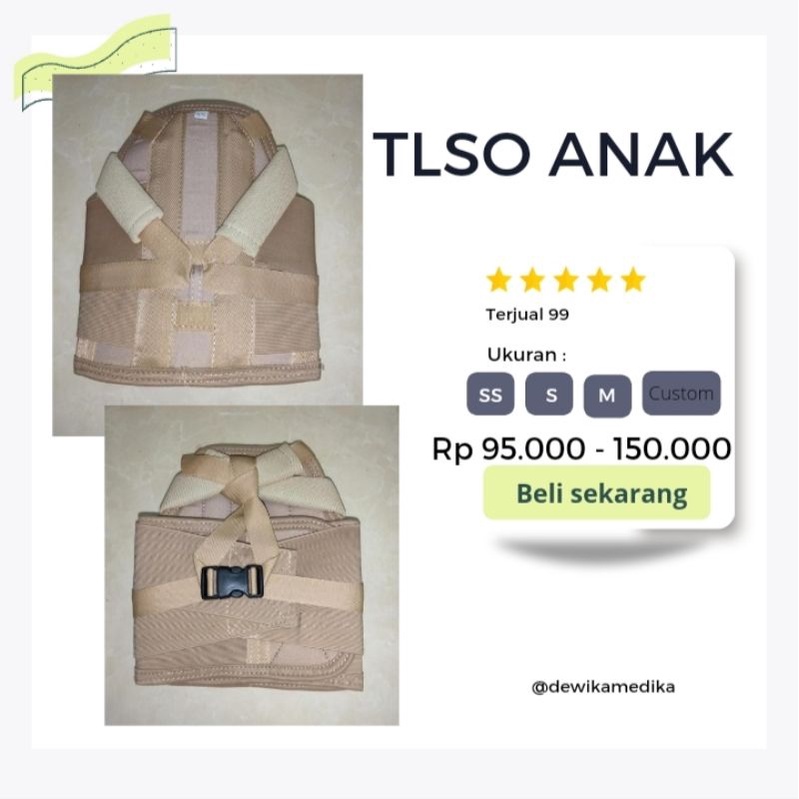 Jual TLSO ANAK / KORSET TLSO / KORSET TULANG BELAKANG/ PENYANGGA TULANG BELAKANG / ALAT ...