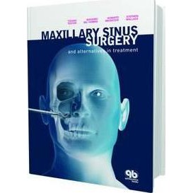 Jual Original-Maxillary Sinus Surgery and Alternative In Treatment ...