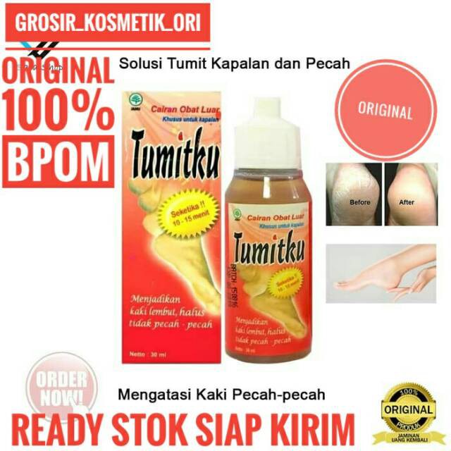 Jual TUMITKU MENGATASI KAKI PECAH - KAPALAN DENGAN INSTAN 30ml | Shopee ...