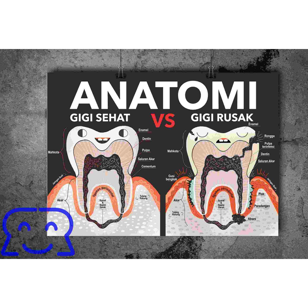 Jual 20 macam/judul poster kesehatan gigi A3+ 31x47cm AP260 (anatomi ...