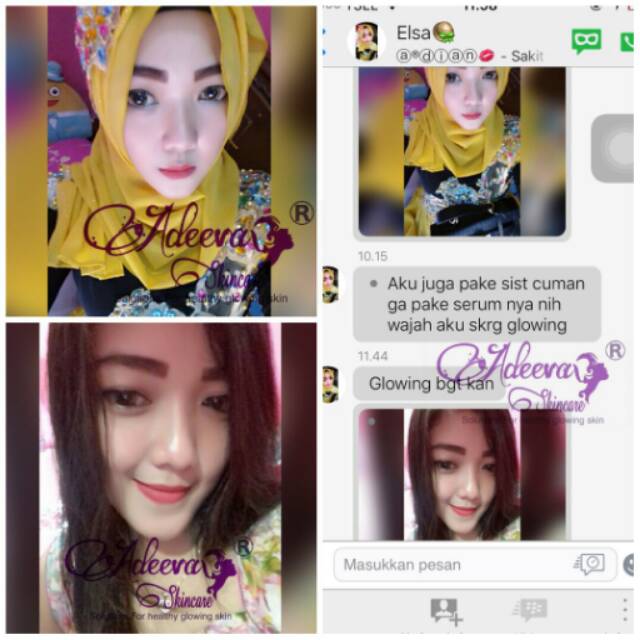 Jual Adeeva White Series (Khusus Kulit Normal) | Shopee Indonesia
