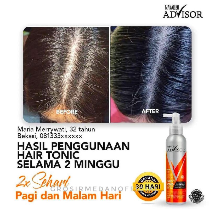 Jual MAKARIZO ANTI HAIR FALL DEFENSE - TONIK ANTI RAMBUT RONTOK DAN ...