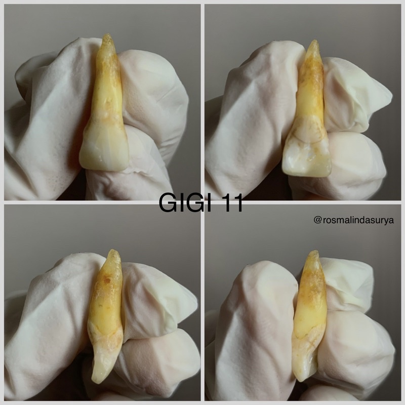 Jual GIGI 11 KONSER ENDO | Shopee Indonesia