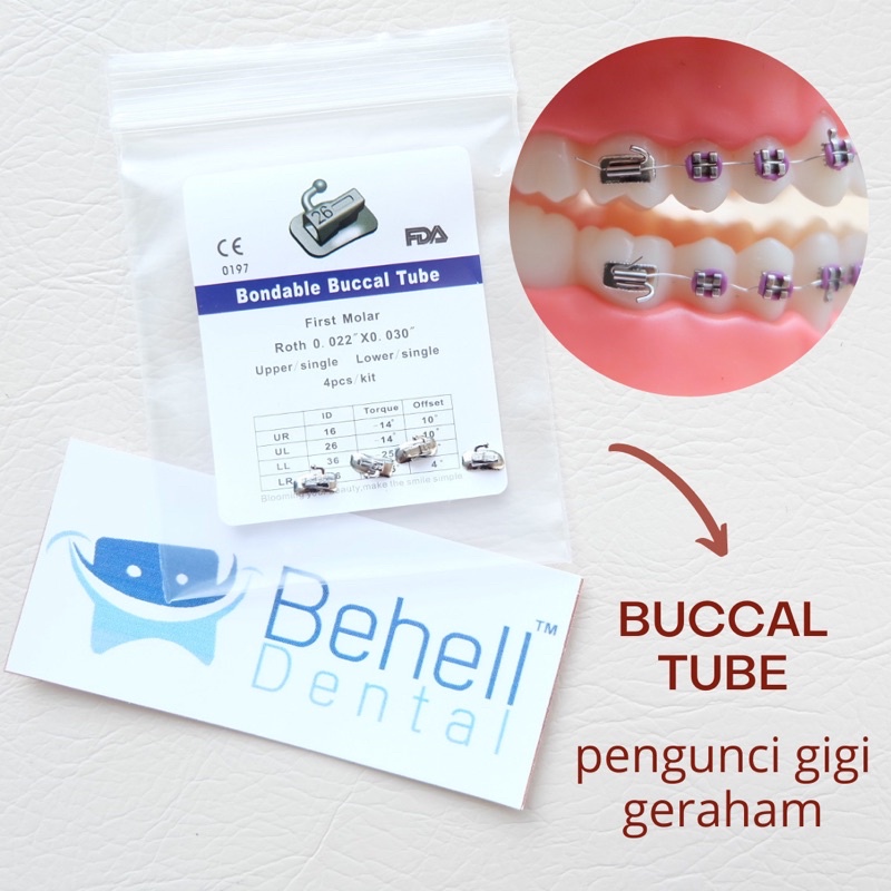 Jual BUCCAL TUBE FDA HIGH QUALITY PENGUNCI BEHEL BRACKET KAWAT GIGI ...