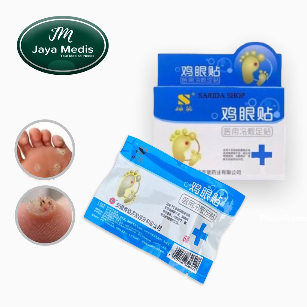 Jual Plester Kutil Mata Ikan - Kaki Kapalan - Ji Yan Gao | Shopee Indonesia