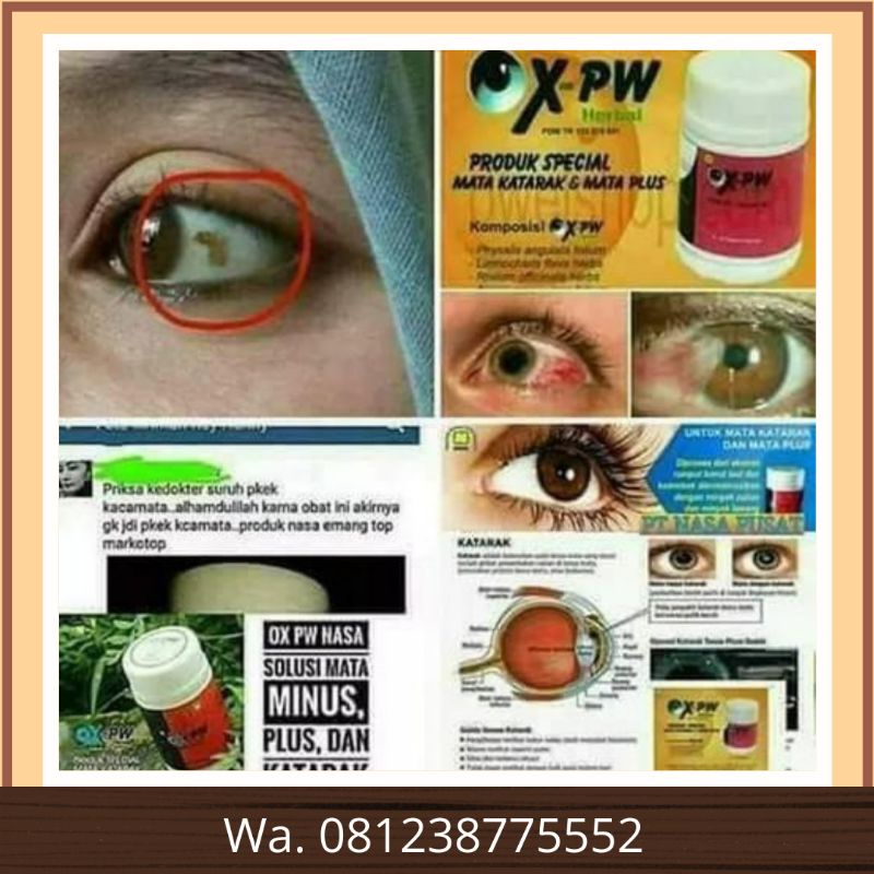 Jual Oxpw-NasaOriginal-ObatKatarak/RabundanMataMinus-AtauPlus | Shopee ...
