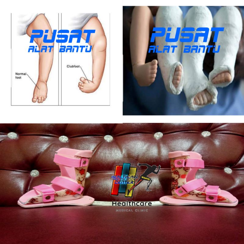 Jual Sepatu koreksi anak CTEV | Shopee Indonesia