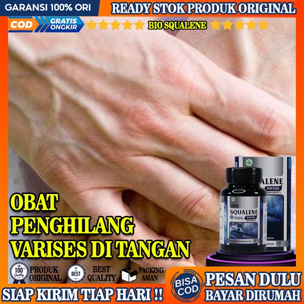 Jual Obat Varises Parises Di Tangan Benjolan Urat Betis Tungkai Kaki ...