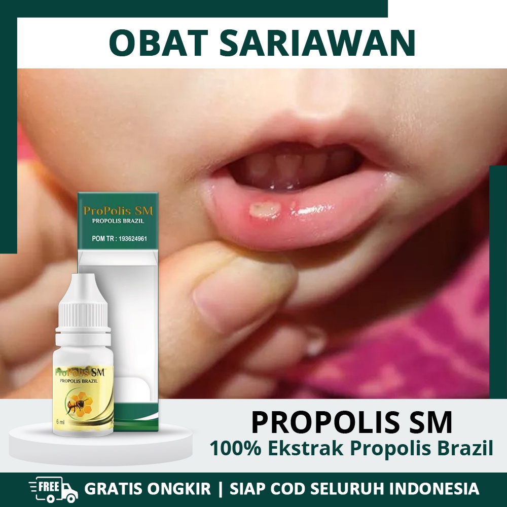 Jual Obat Tetes Sariawan Luka Di Bibir / Mulut Perih Gusi Bengkak ...