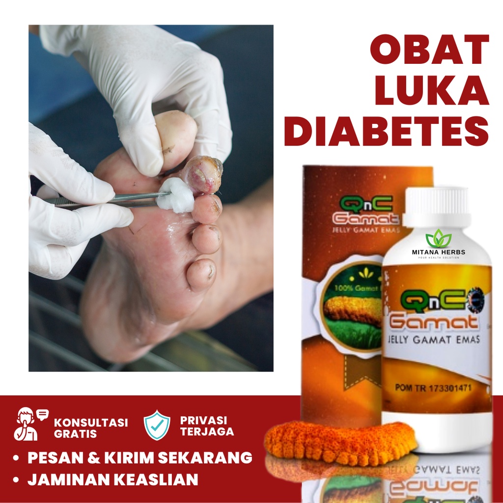 Jual Mitana Herbal, Obat Luka Diabetes Agar Cepat Kering, Obat Luka ...