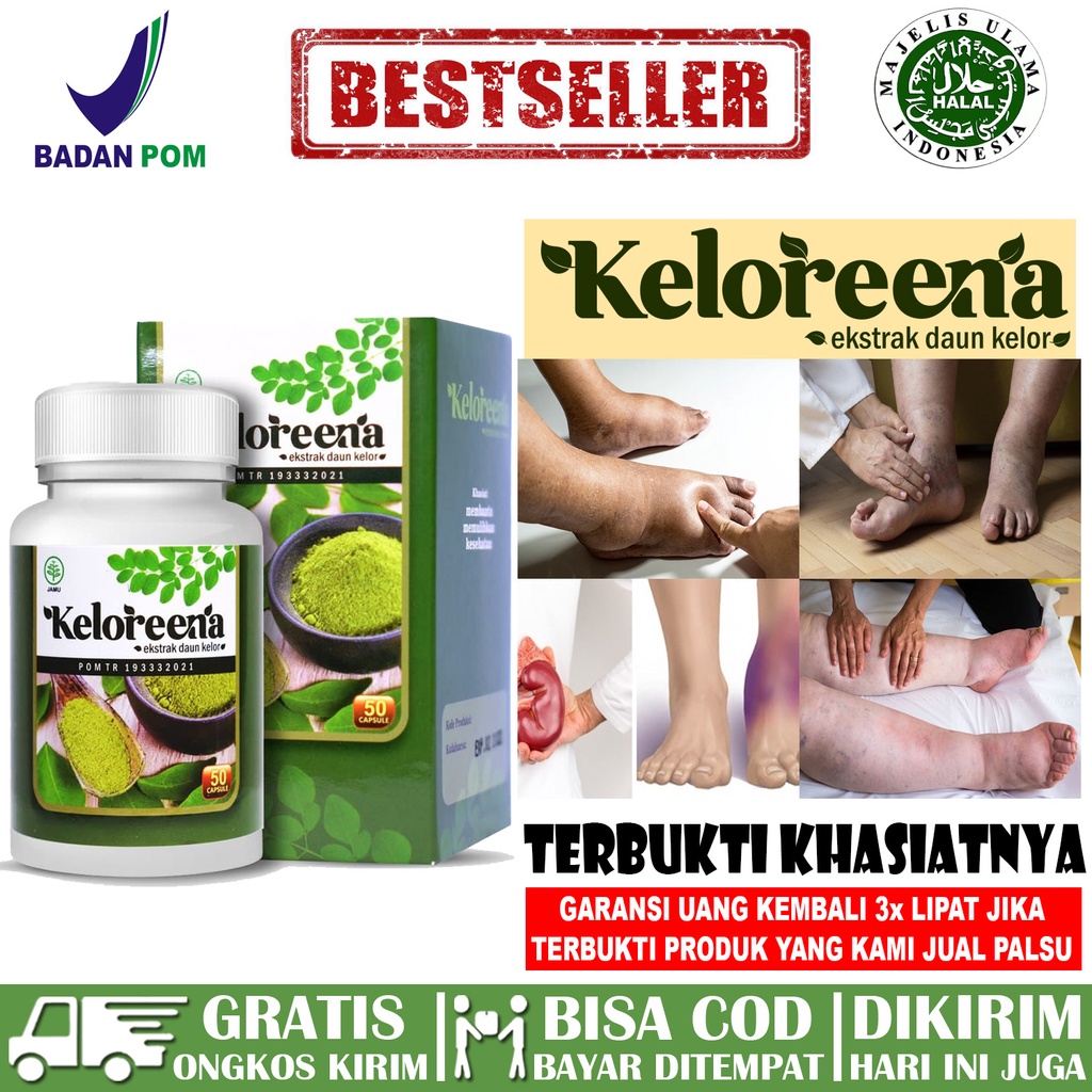 Jual Obat Kaki Bengkak Gejala Dari Penyakit Ginjal Sindrom Nefrotik ...