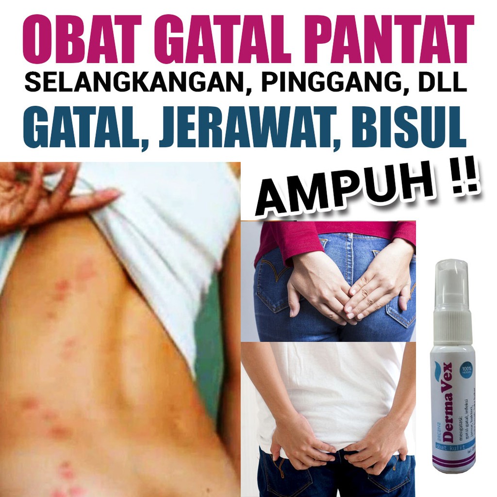 Jual Obat Pantat Gatal, Punggung, Kaki. Herbal - Dermavex Spray 25ml ...