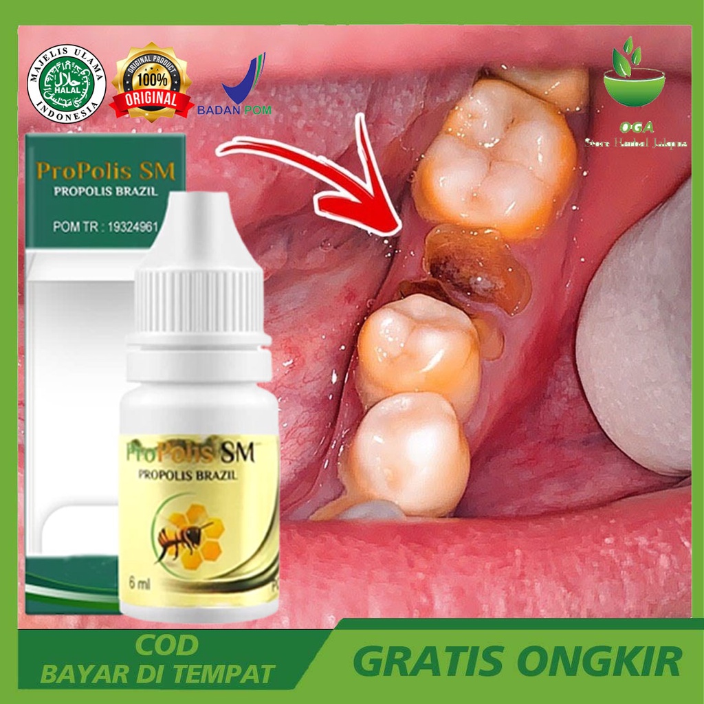 Jual Obat Gigi Keropos, Gigi Bolong, Gusi Berdarah, Sakit Gigi, Penguat ...