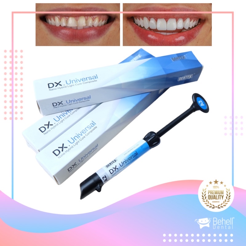 Jual COMPOSITE DENTEX Universal DX A1 A2 A3 A3.5 - Dental Bahan Direct Veneer Veneers Gigi ...