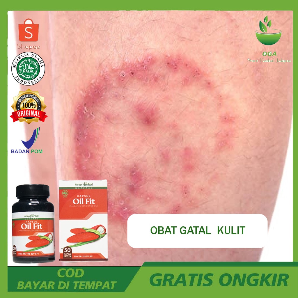 Jual Obat Gatal Gatal Pada Kulit - Obat Gatal Gatal Pada Kulit ...
