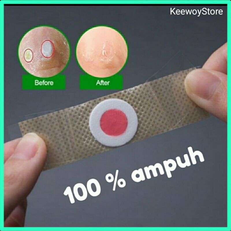 Jual Plester obat kutil mata ikan kapalan 1 pcs | Shopee Indonesia