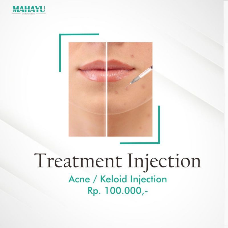 Jual acne injection / keloid injection | Shopee Indonesia