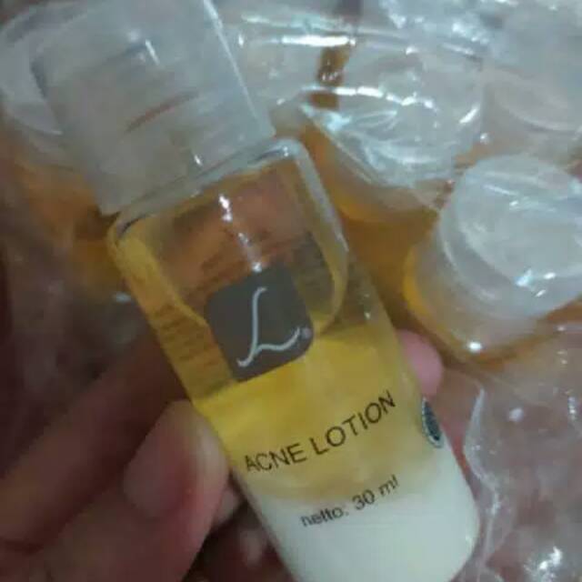 Jual Prevelod Acne Lotion Larissa | Shopee Indonesia