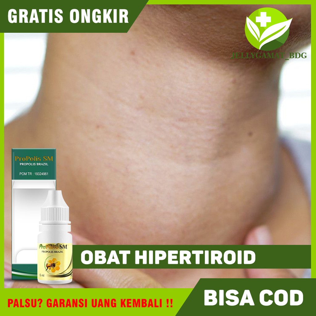 Jual Obat Hipertiroid, Tiroid Membengkak, Kelenjar Tiroid, Leher ...