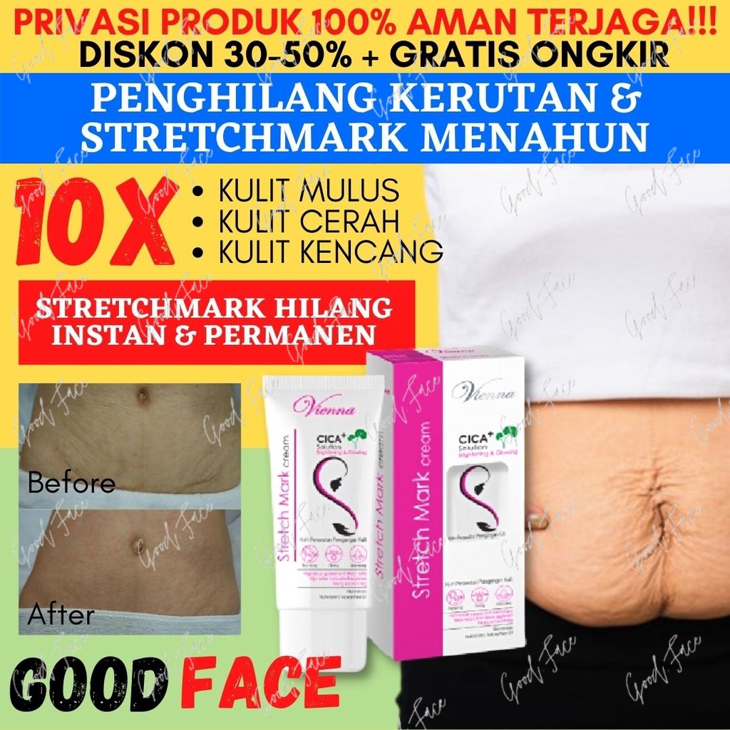 Jual VIENNA CREAM STRETCH MARK ORIGINAL BPOM PENGHILANG STRECHMARK KRIM ...