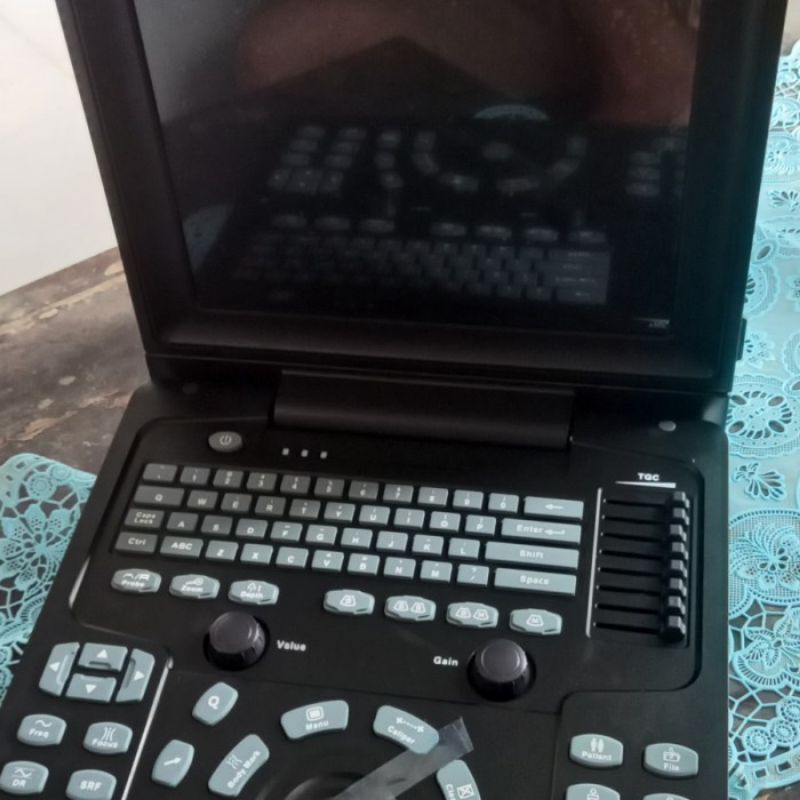 Jual USG portable doppler zoncare i50 | Shopee Indonesia