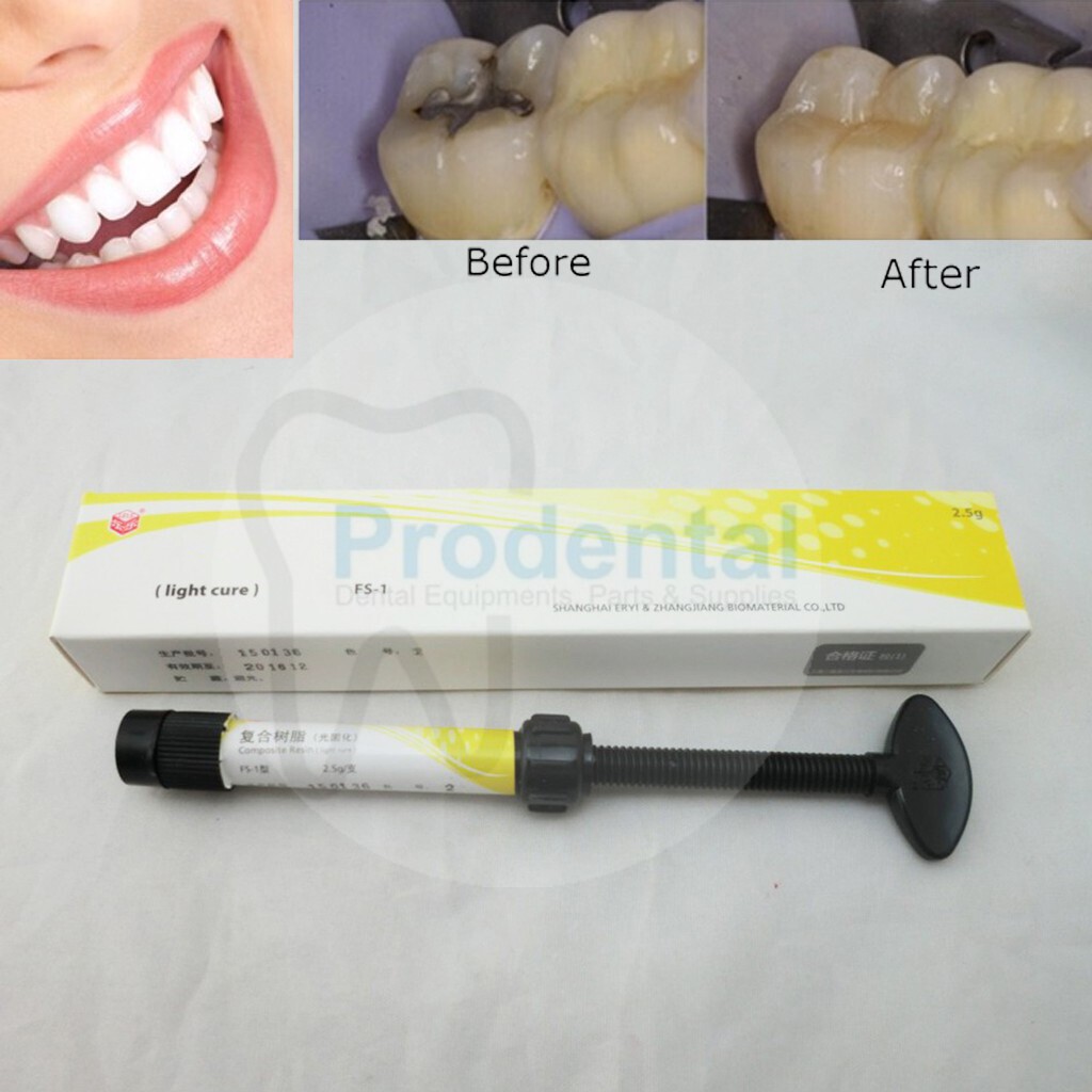 Jual Lem behel veneer komposit bahan tambal gigi veneer light cure ...