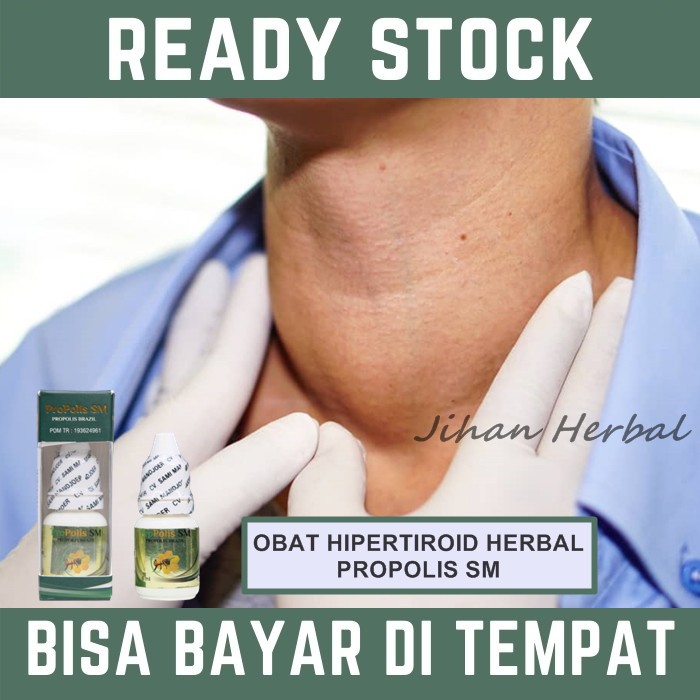 Jual Obat Hipertiroid, Tiroid bengkak, Kelenjar Tiroid, Gondok ...