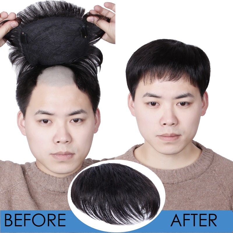 Jual WIG TOUPEE / RAMBUT PALSU PENUTUP BOTAK PRIA COWOK PRIA / LAKI ...