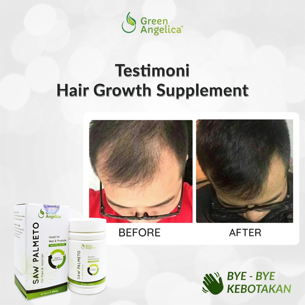 Jual BEST SELLER Suplemen Herbal Penumbuh Rambut Alami Cepat Ampuh ...