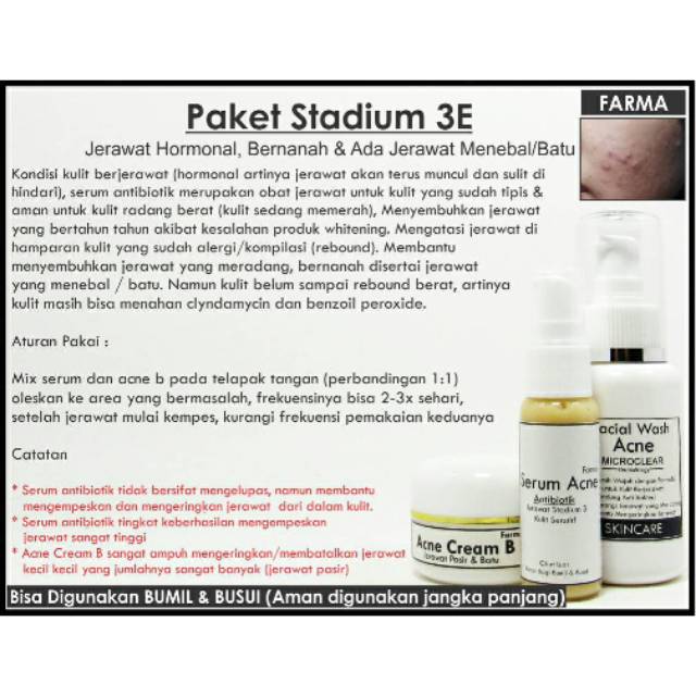 Jual Pkt stadium 3E | Shopee Indonesia