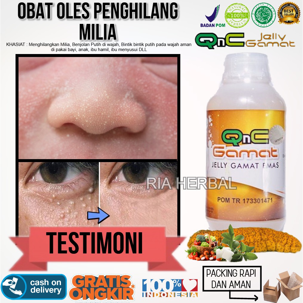 Jual Obat Oles / Salep Milia di Wajah Muka Sekitar Hidung Kelopak Mata ...