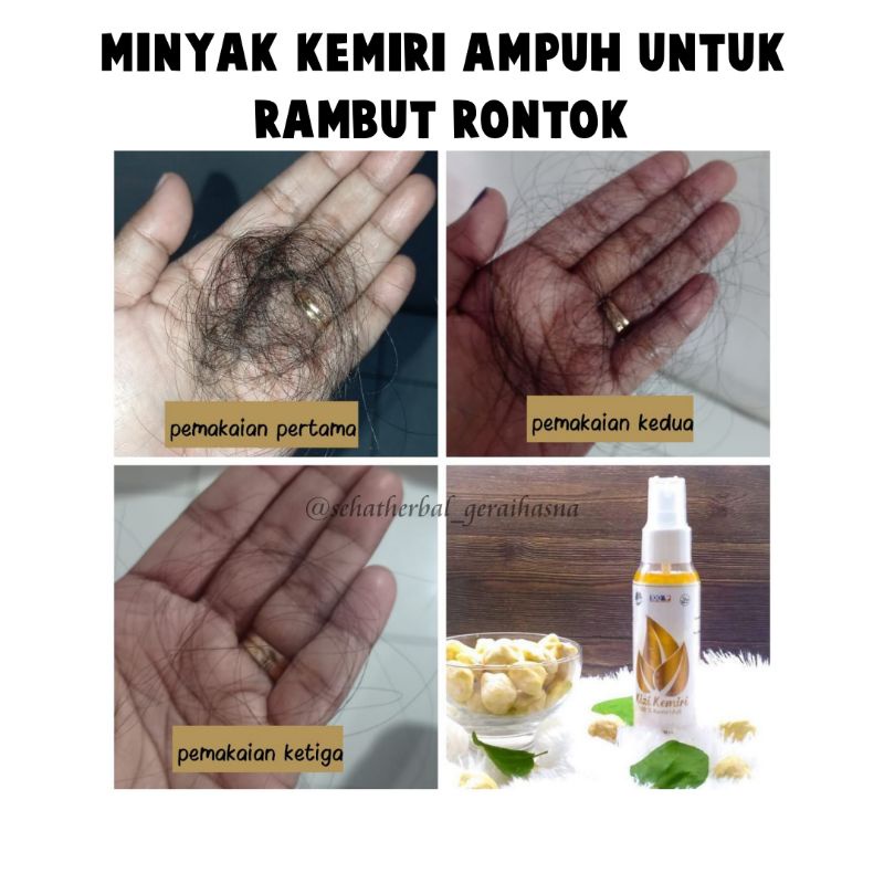Jual Minyak Kemiri, Penumbuh Rambut Cepat, Minyak Kemiri Asli, Minyak ...