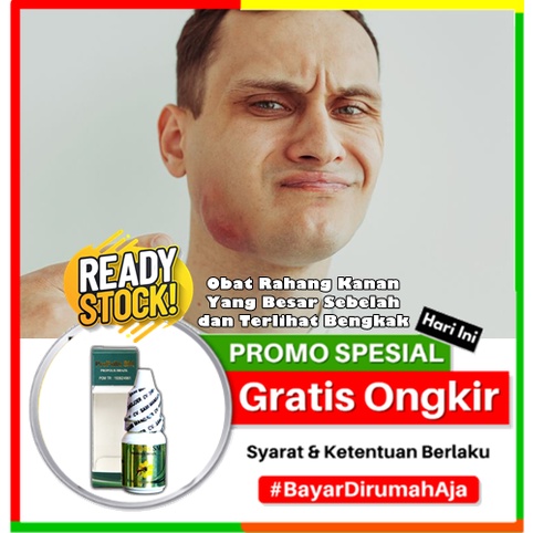 Jual Obat Rahang Kanan Yang Besar Sebelah dan Terlihat Bengkak, Atasi ...