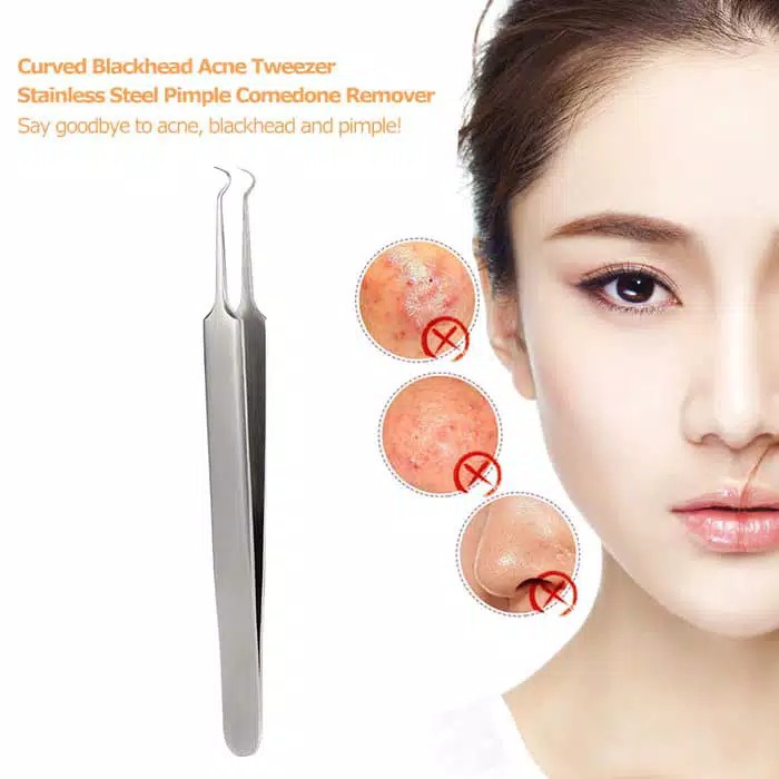 Jual Pinset Jepit Komedo - Blackhead Tweeze TWEEZER | Shopee Indonesia