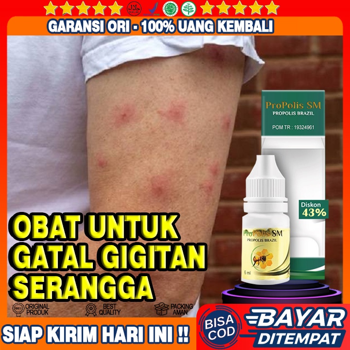 Jual Obat Gatal Digigit Serangga, Obat Bentol Digigit Serangga, Obat ...