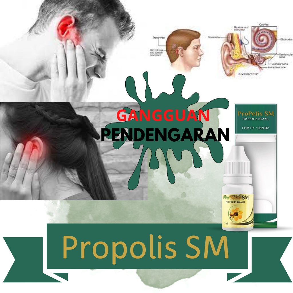 Jual PROPOLIS SM - Obat Tuli, Obat Herbal Telinga Tuli, Saraf Telinga ... Jual PROPOLIS SM - Obat Tuli, Obat Herbal Telinga Tuli, Saraf Telinga ...